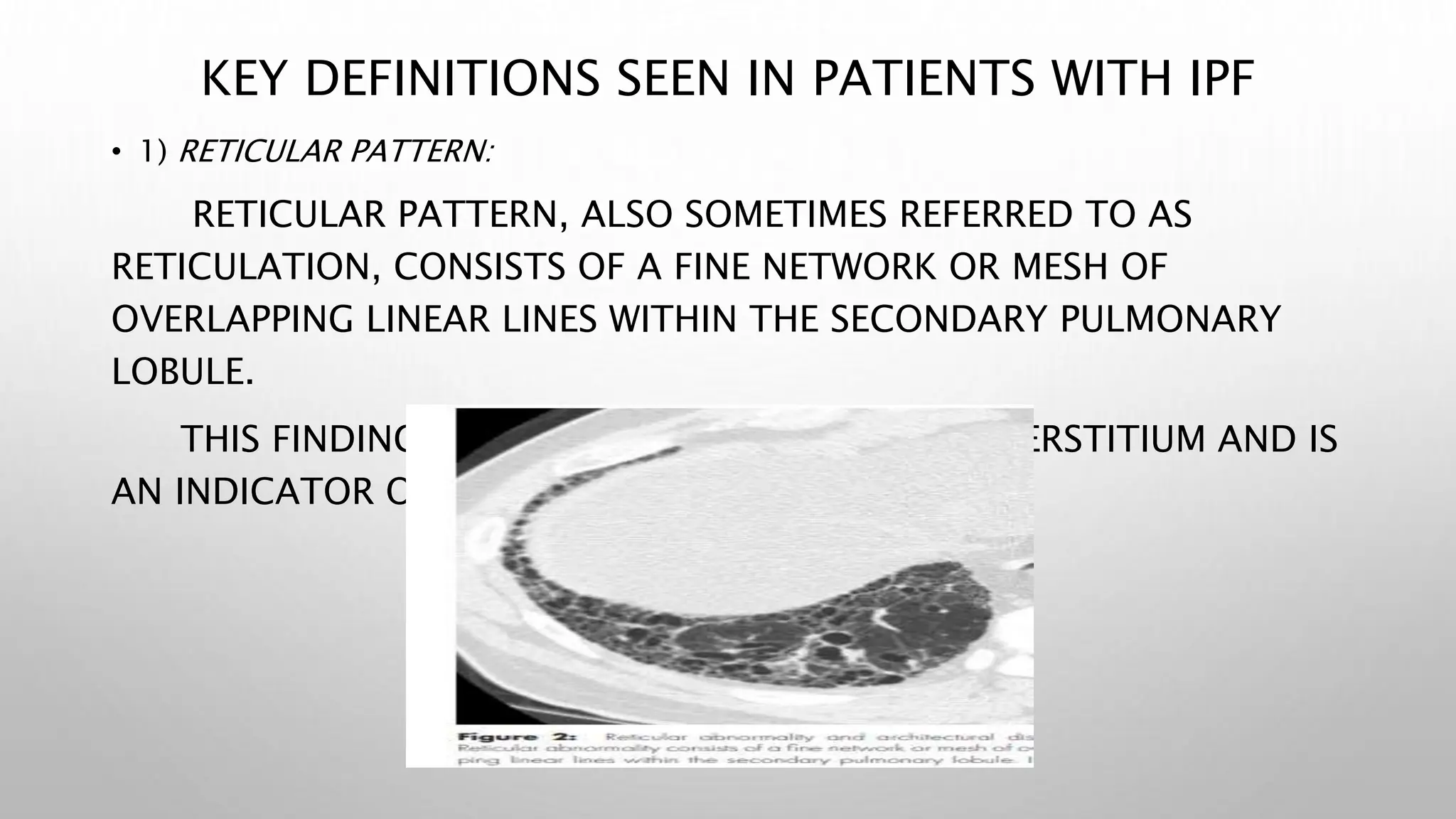 ILD clinical update.pptx
