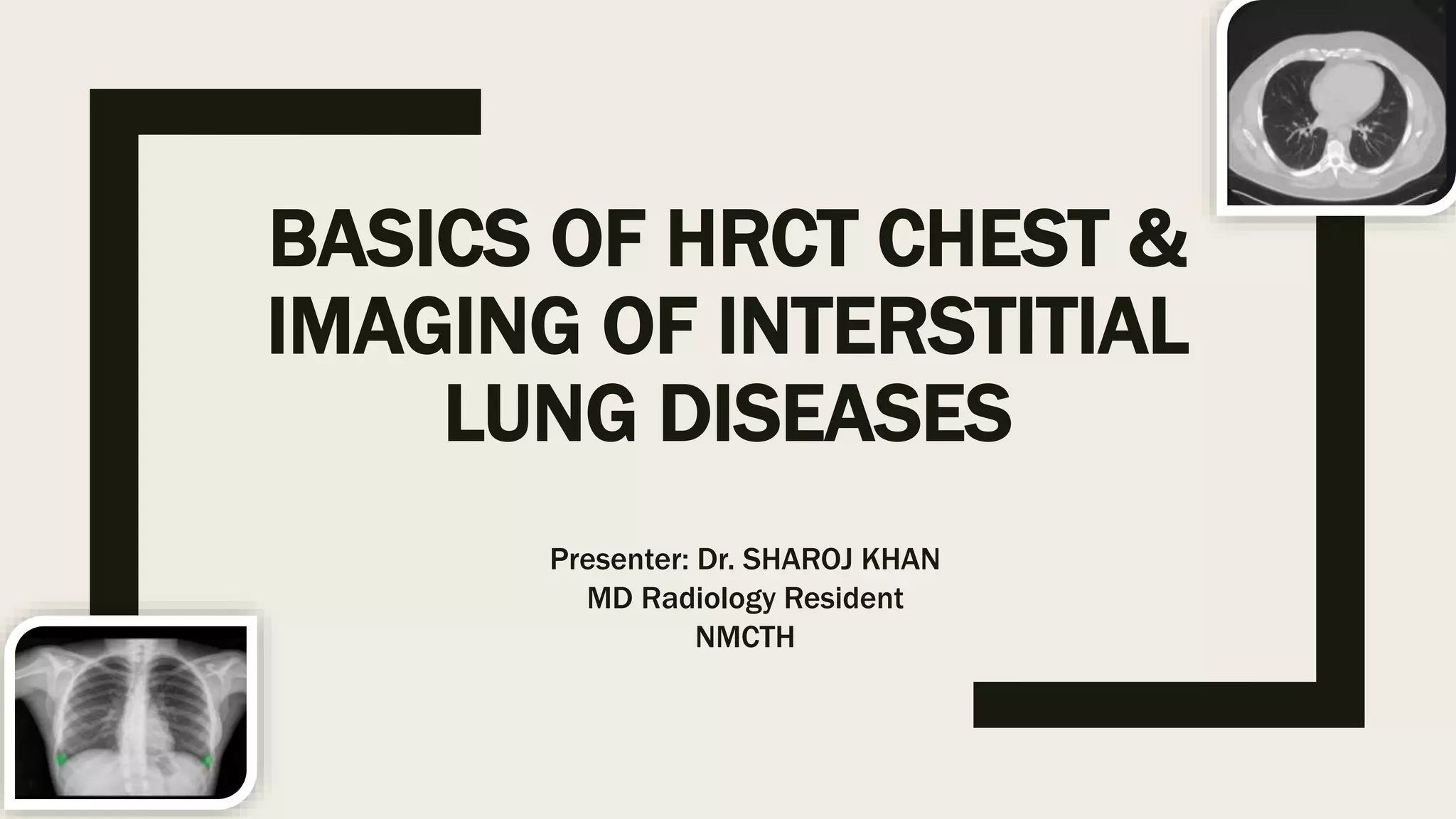 Interstitial lung disease and Occupational lung disease HRCT | PPTX