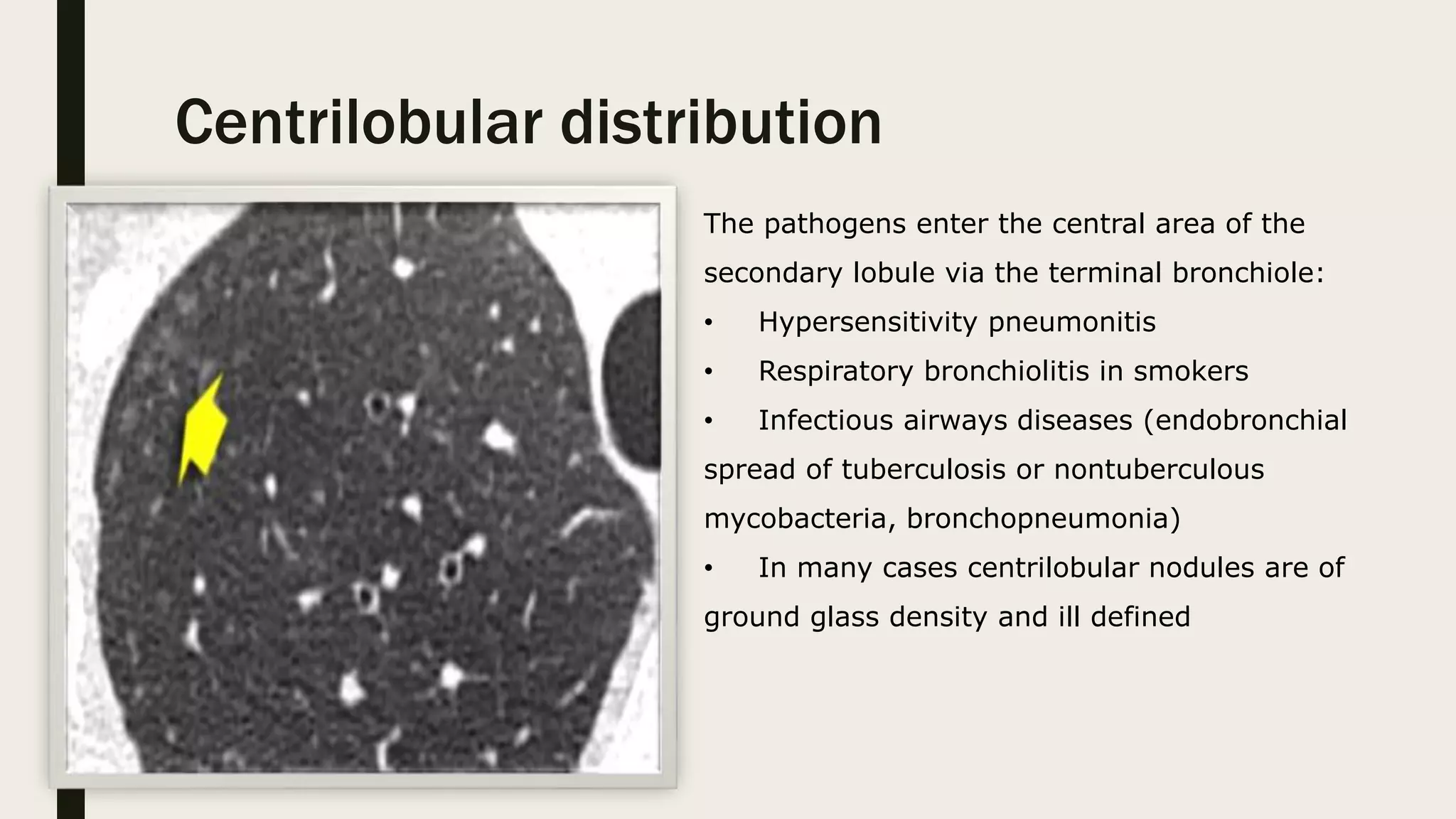 Interstitial lung disease and Occupational lung disease HRCT | PPTX