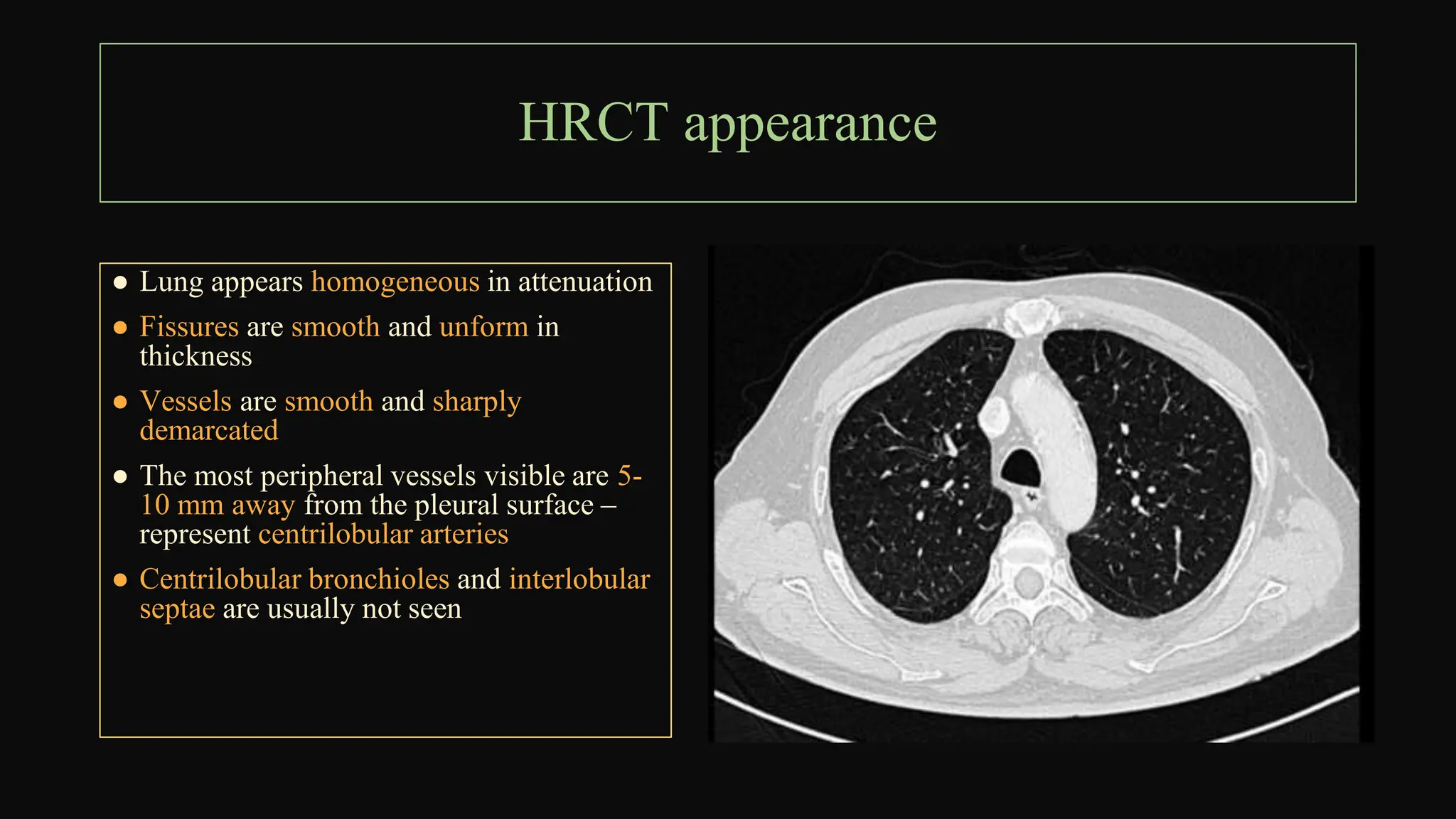 INTERSTITIAL LUNG DISEASE Pattern Approach main.pptx