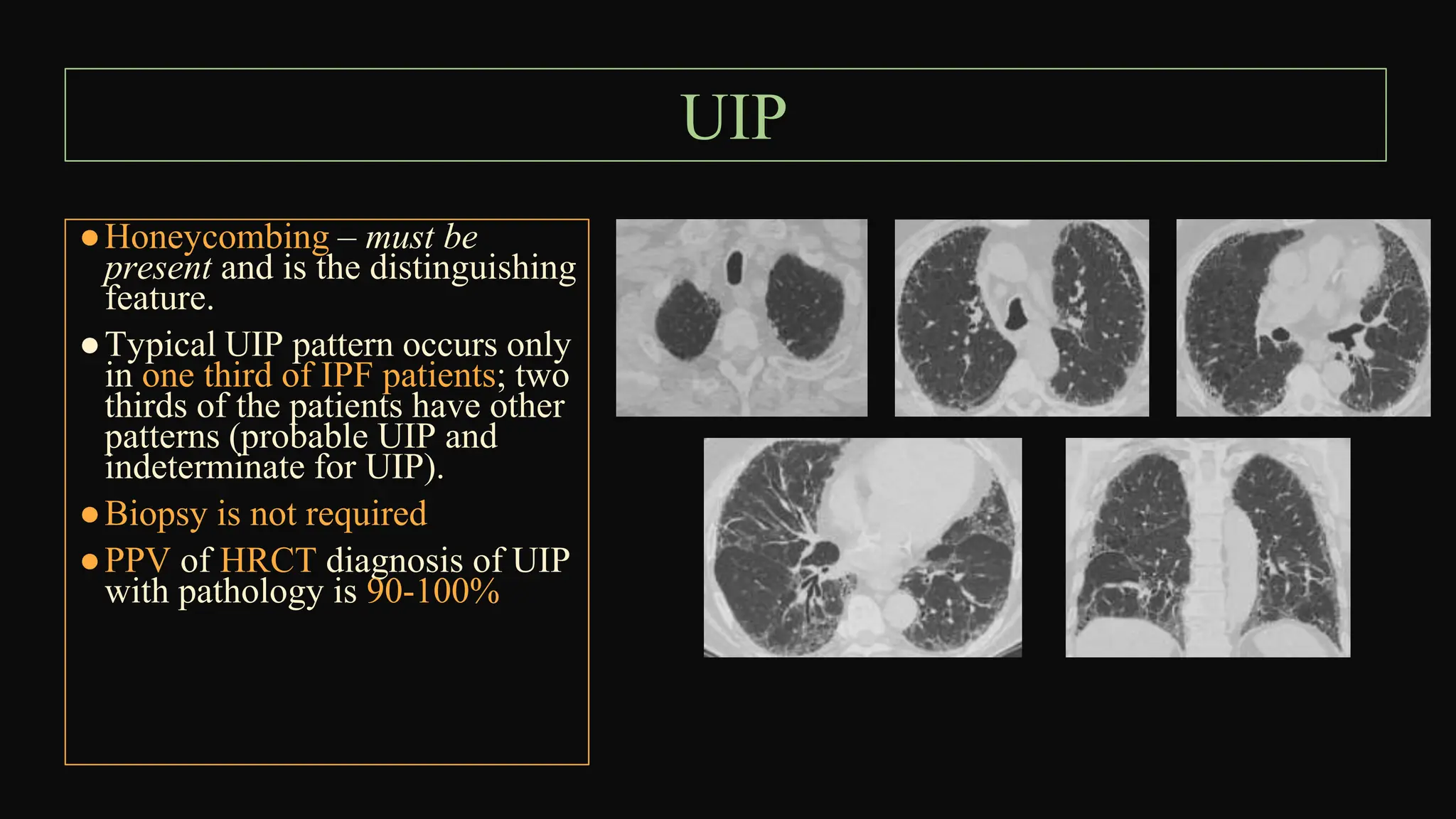 INTERSTITIAL LUNG DISEASE Pattern Approach main.pptx