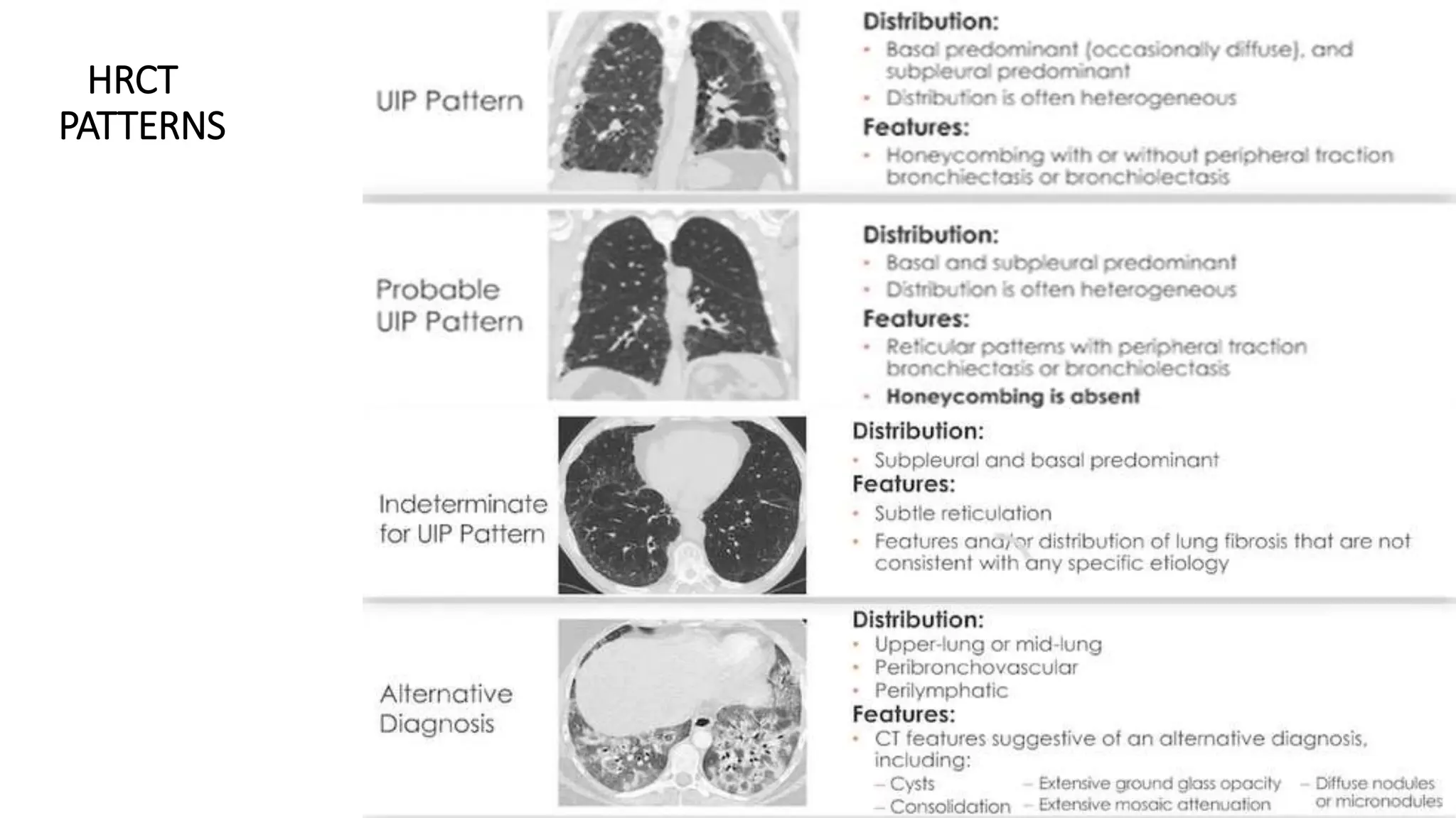 ILD presentation.pptx