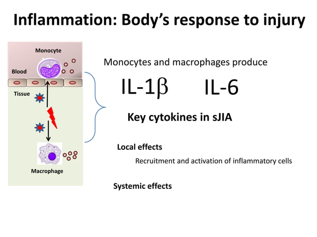 Immune Mechanisms of Inflamation in SJIA | PPTX