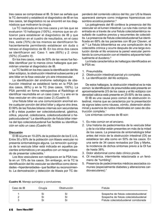 Ileo Biliar | PDF