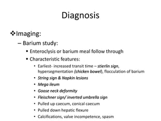 Ileocaecal tb | PPTX | Digestive Disorders | Diseases and Conditions