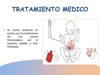 Ileo meconial | PPTX