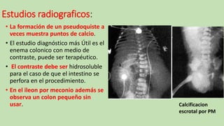 Ileo meconial | PPTX