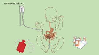 Ileo meconial | PPTX