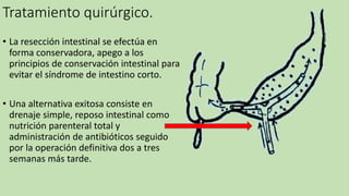 Ileo meconial | PPTX