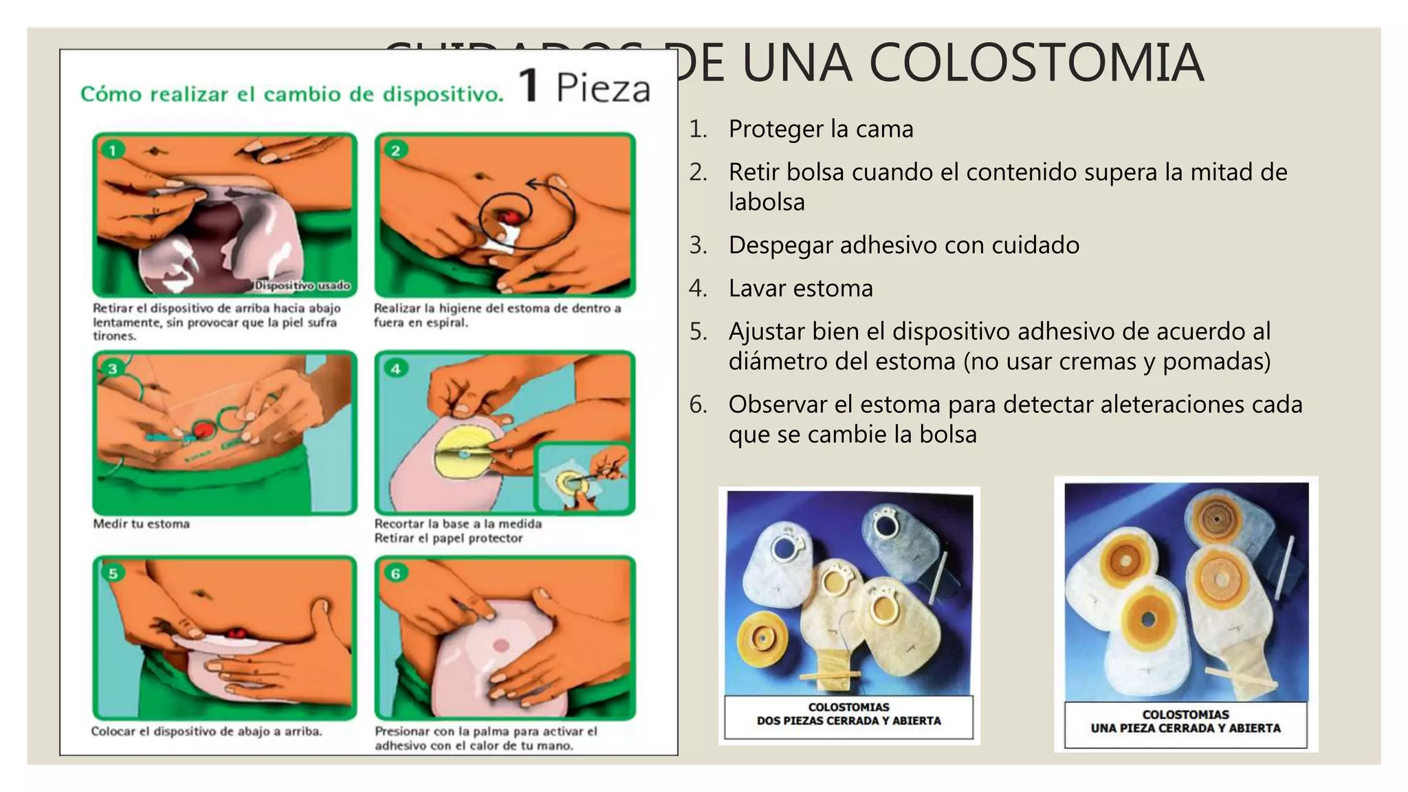 Ileostomía y colostomía | PPTX