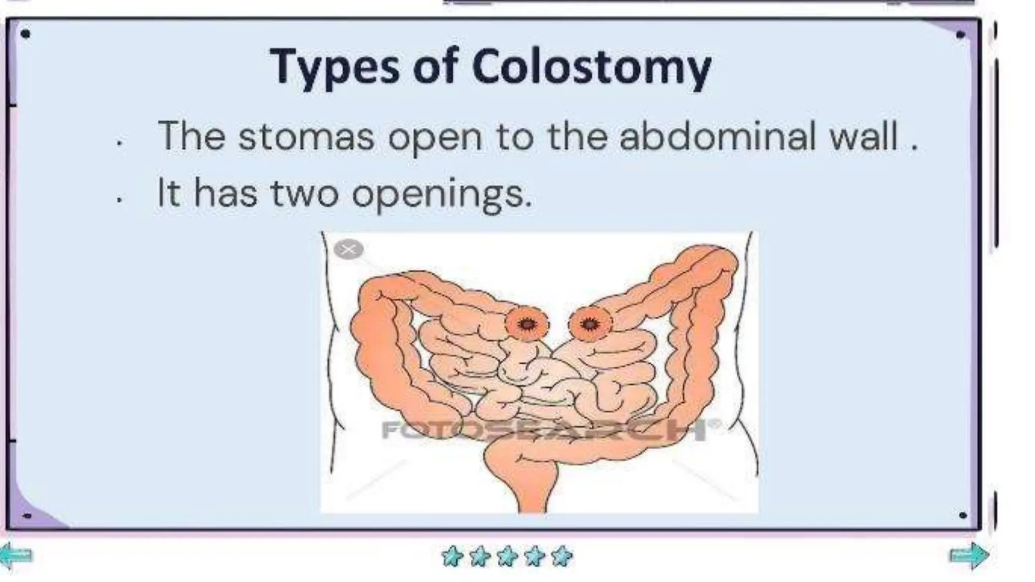 ileostom colostomy care and irrigation new1.pptx