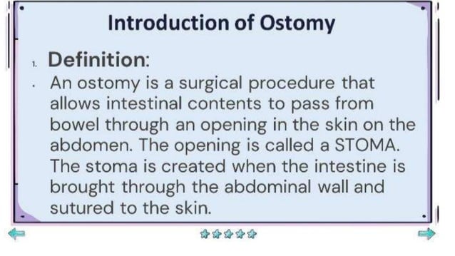 ileostom colostomy care and irrigation new1.pptx