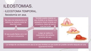 ileostomias.pptx