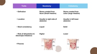 Ileostomy-_-Colostomy-Bag-Management.pptx