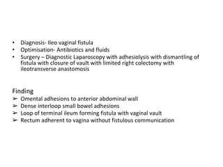 Ileo vaginal fistula management.pptx