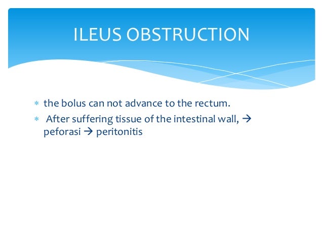 Ileus obstruction