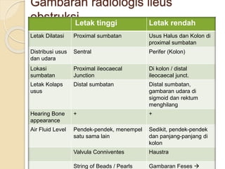 Ileus obstruktif | PPTX