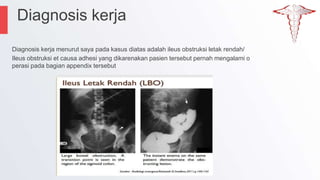ileus obstruksi.pptx