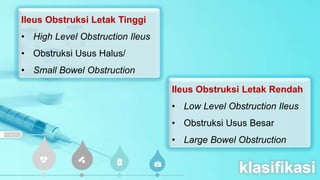 Ileus obstruksi | PPTX