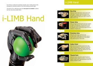 i-LIMB Bionic Hand | PDF | Physical Therapy | Wellness