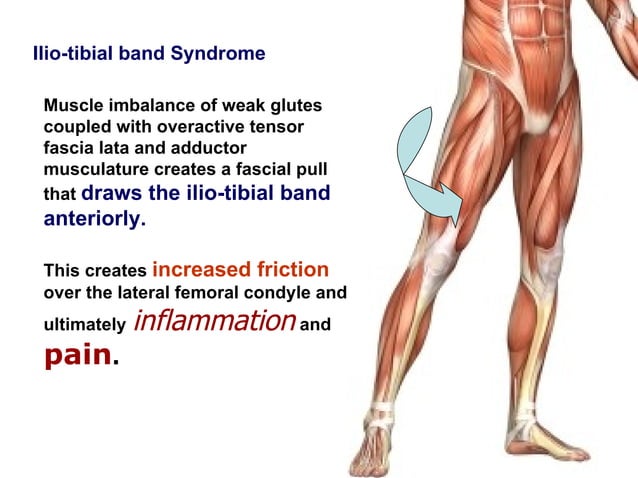 Condition of the Week - Ilio-tibial Band Syndrome | PPT | Physical ...