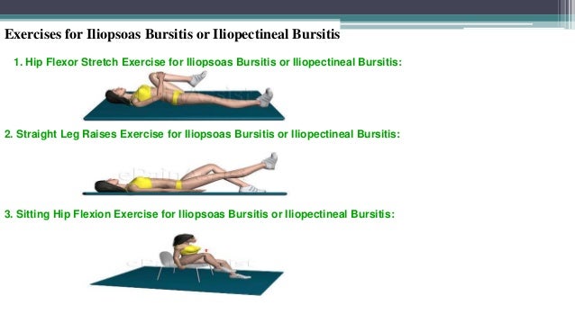 Iliopsoas Bursitis Stretches