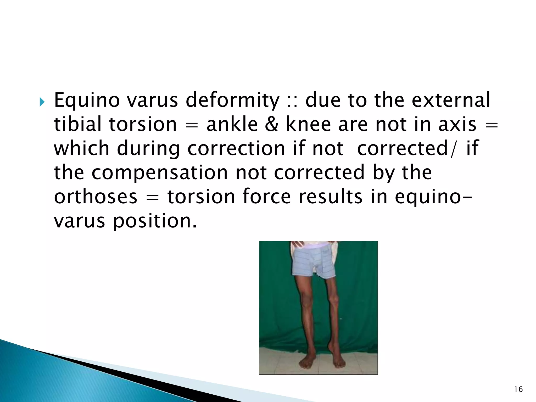 Iliotibial band contracture | PPTX