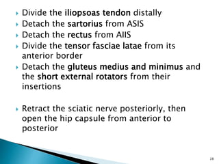 Iliotibial band contracture | PPT
