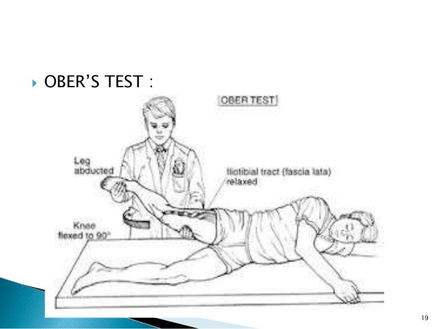Iliotibial band contracture