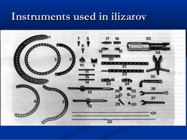 Ilizarov fixator