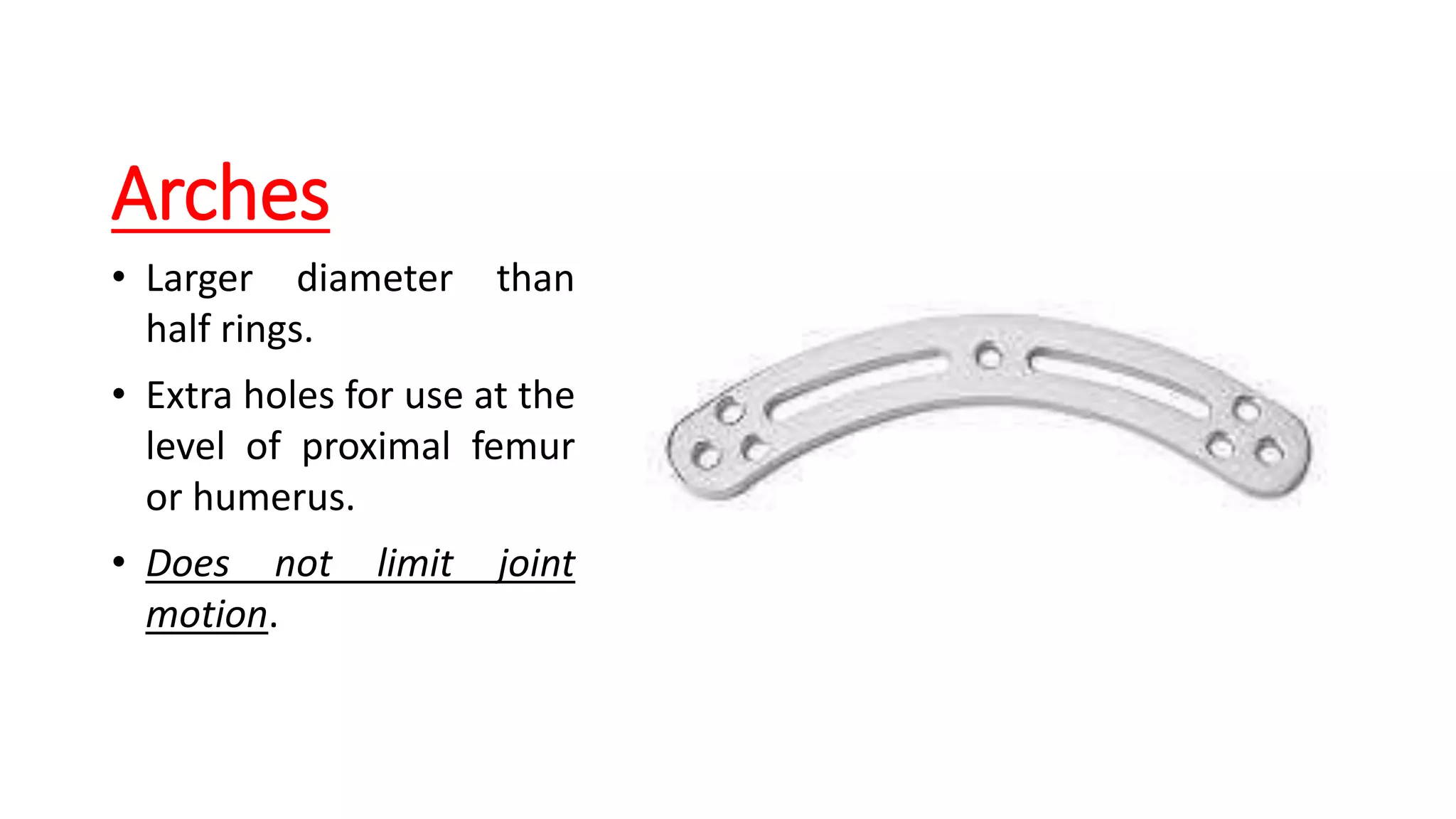 ILIZAROV EXTERNAL FIXATOR | PPTX