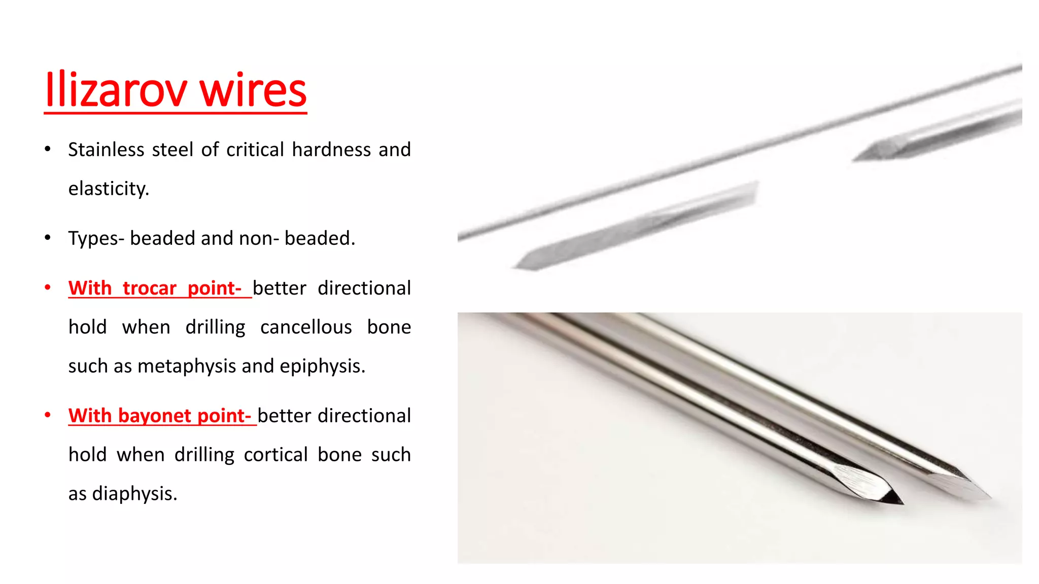 ILIZAROV EXTERNAL FIXATOR | PPTX