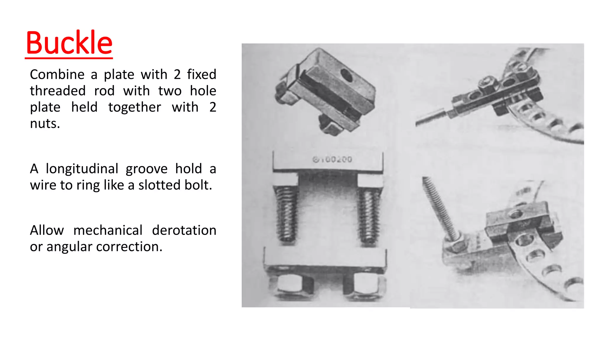 ILIZAROV EXTERNAL FIXATOR | PPTX