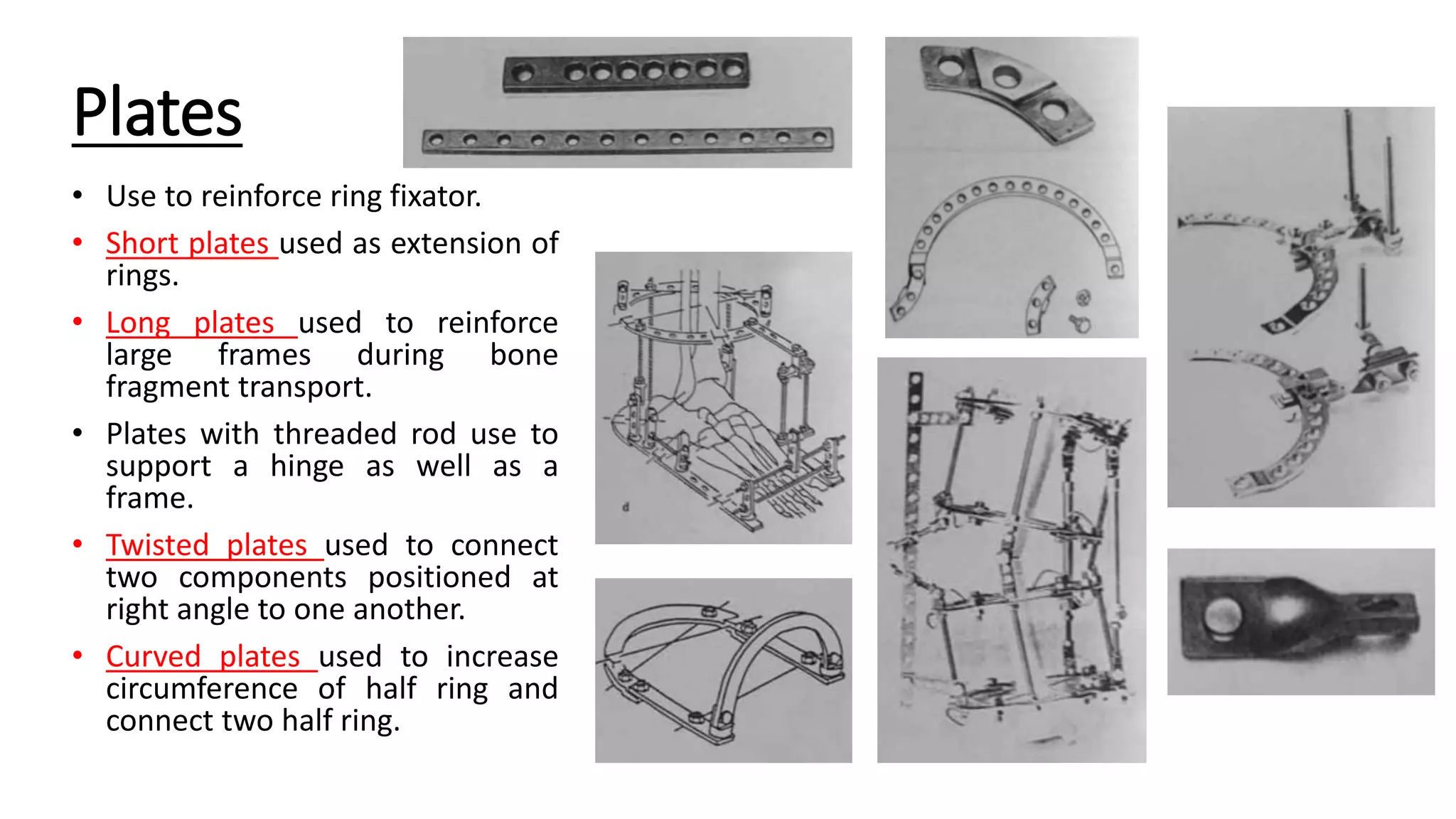 ILIZAROV EXTERNAL FIXATOR | PPTX