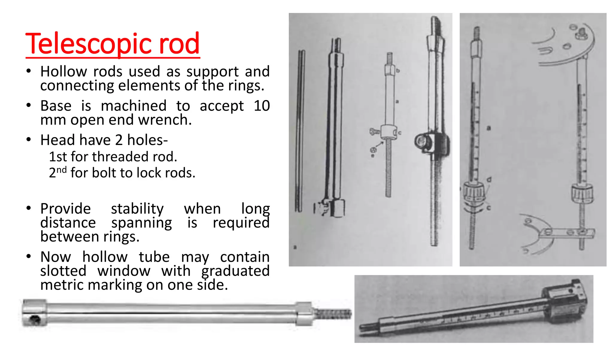 ILIZAROV EXTERNAL FIXATOR | PPTX