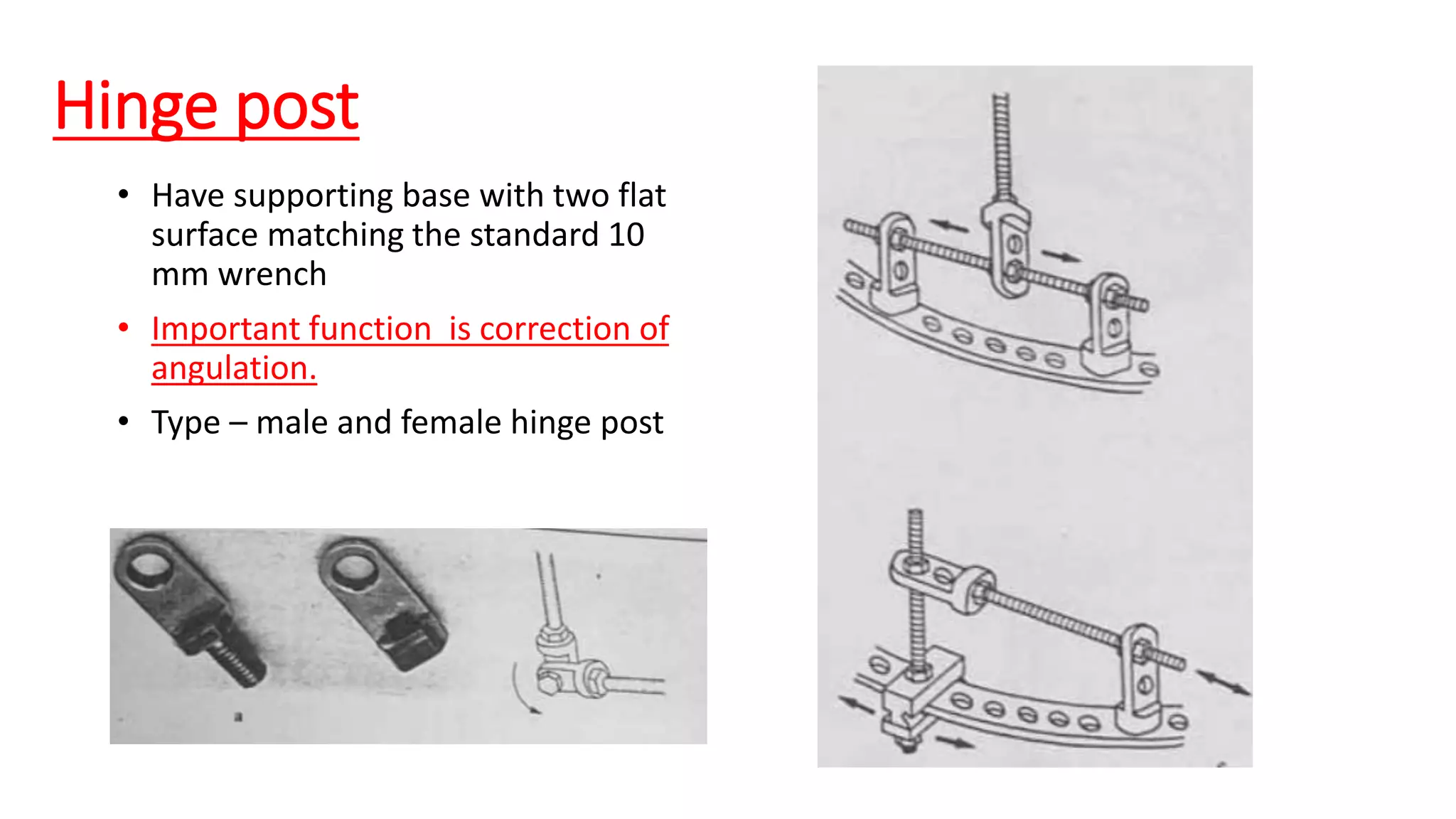 ILIZAROV EXTERNAL FIXATOR | PPTX