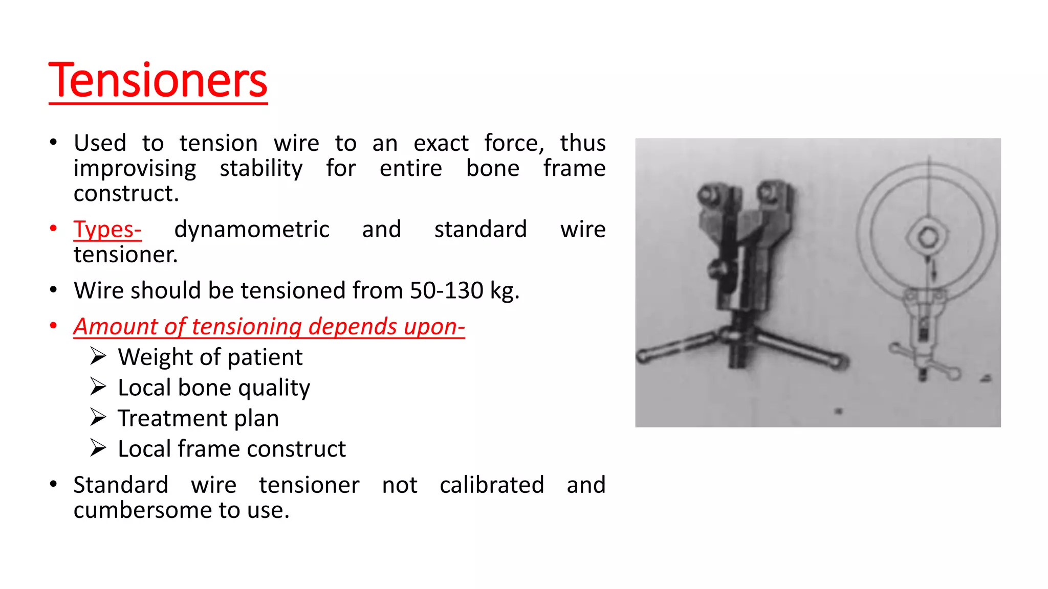 ILIZAROV EXTERNAL FIXATOR | PPTX