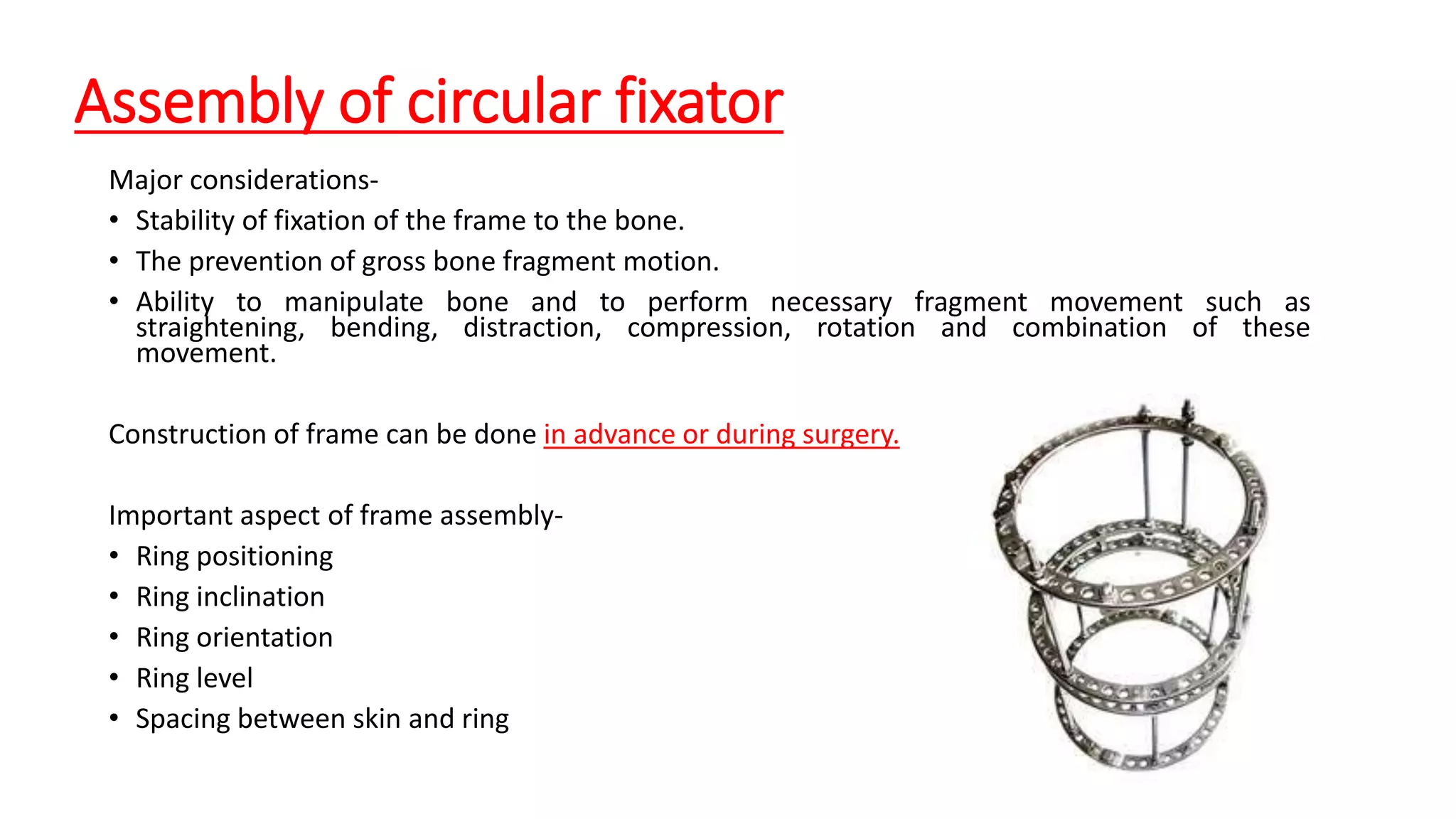 ILIZAROV EXTERNAL FIXATOR | PPTX