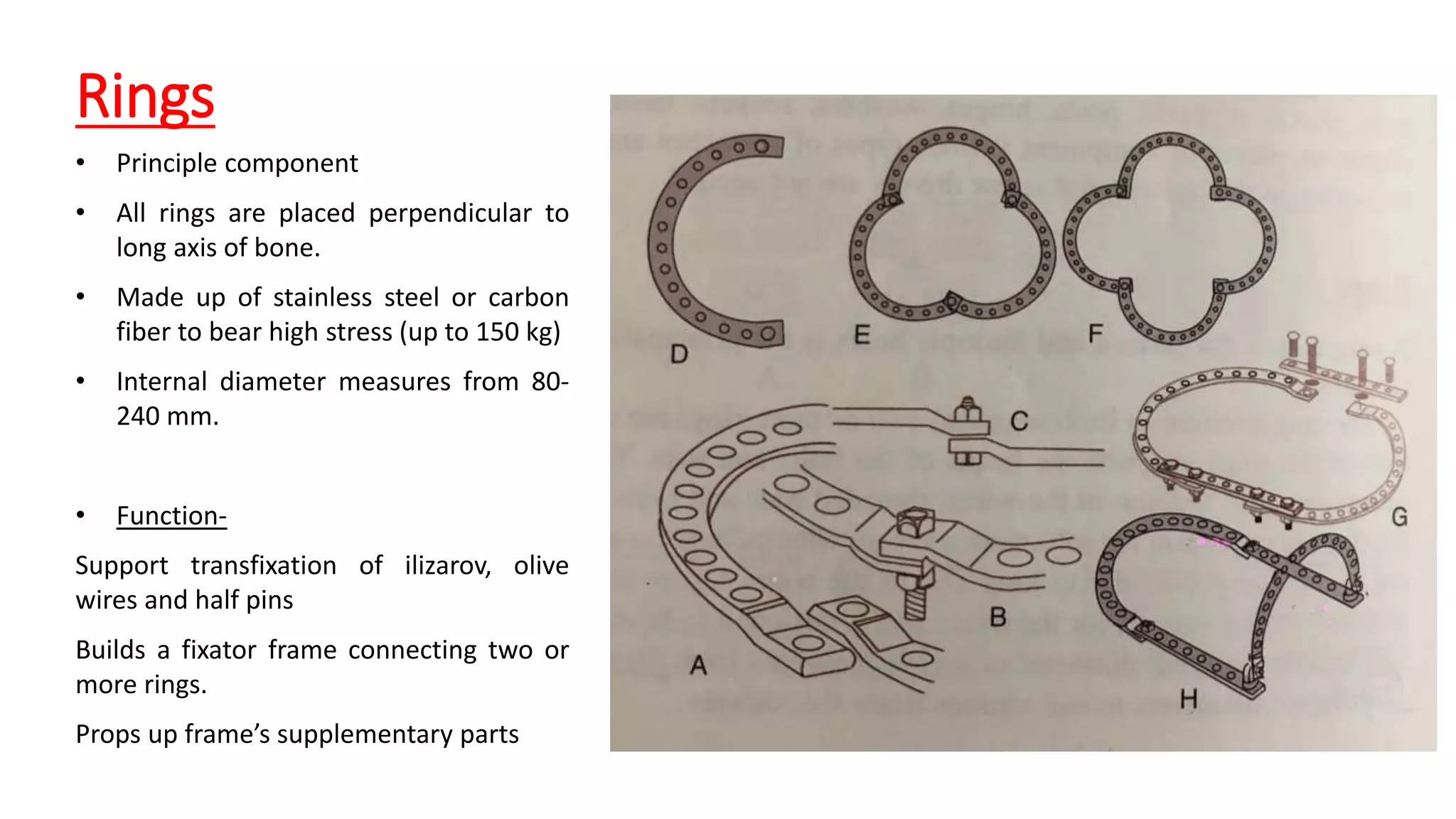ILIZAROV EXTERNAL FIXATOR | PPTX