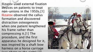 Ilizarov external fixator | PPTX