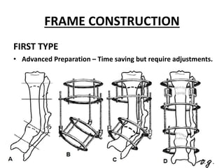 Ilizarov frame assemblage | PPTX