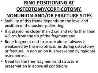 Ilizarov frame assemblage | PPTX
