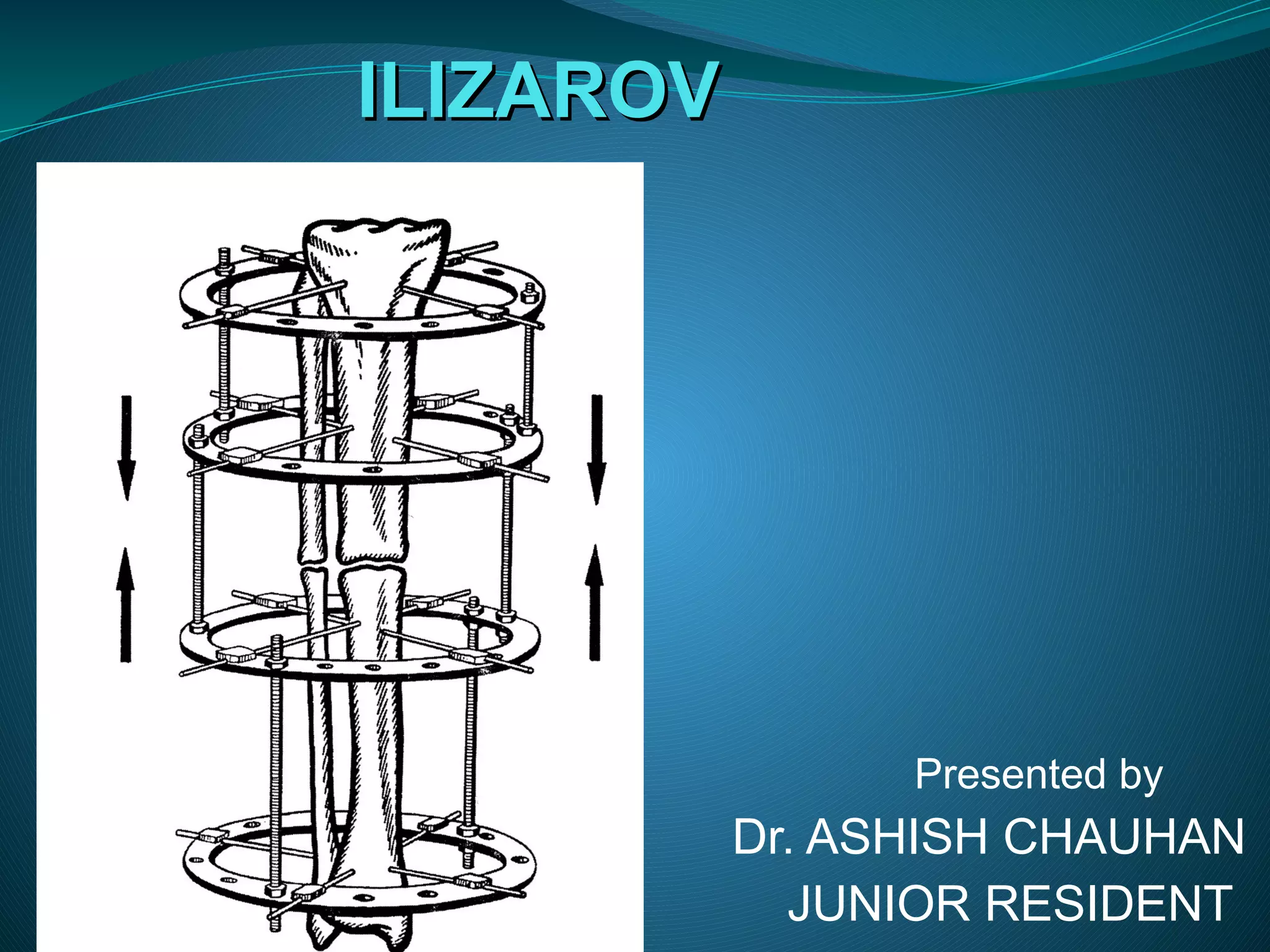 Ilizarov Instrumentation 2-2.pdf
