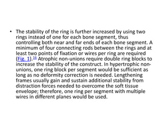 Ilizarov principles of deformity correction.pptx