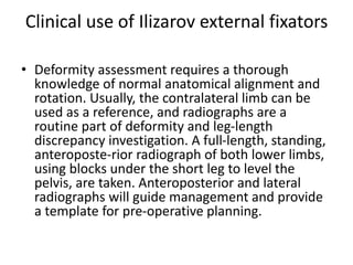 Ilizarov principles of deformity correction.pptx