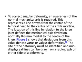 Ilizarov principles of deformity correction.pptx