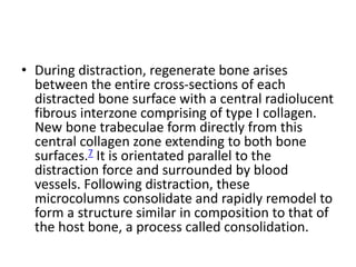 Ilizarov principles of deformity correction.pptx