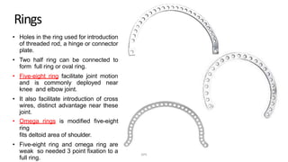 Ilizarov ring fixator | PPT