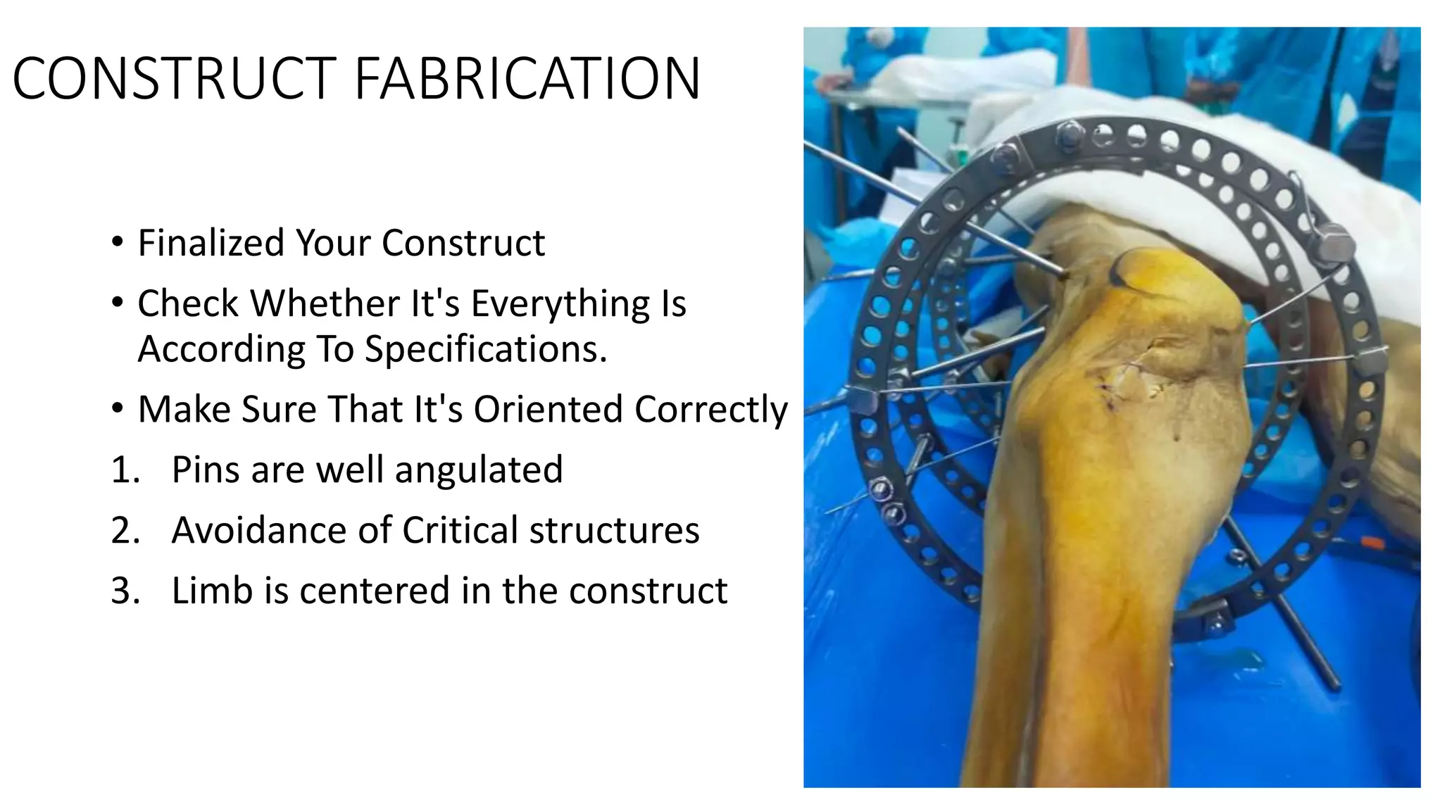 ILIZAROV RING FIXATOR.pptx