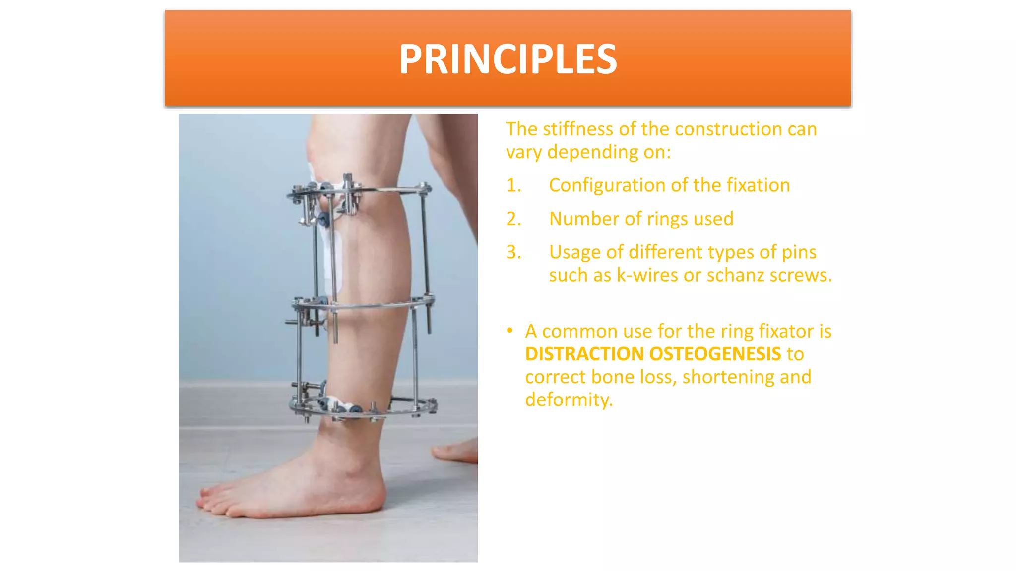 ILIZAROV RING FIXATOR.pptx